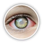 Sohum Eye Care Centre – Provider of total eye care